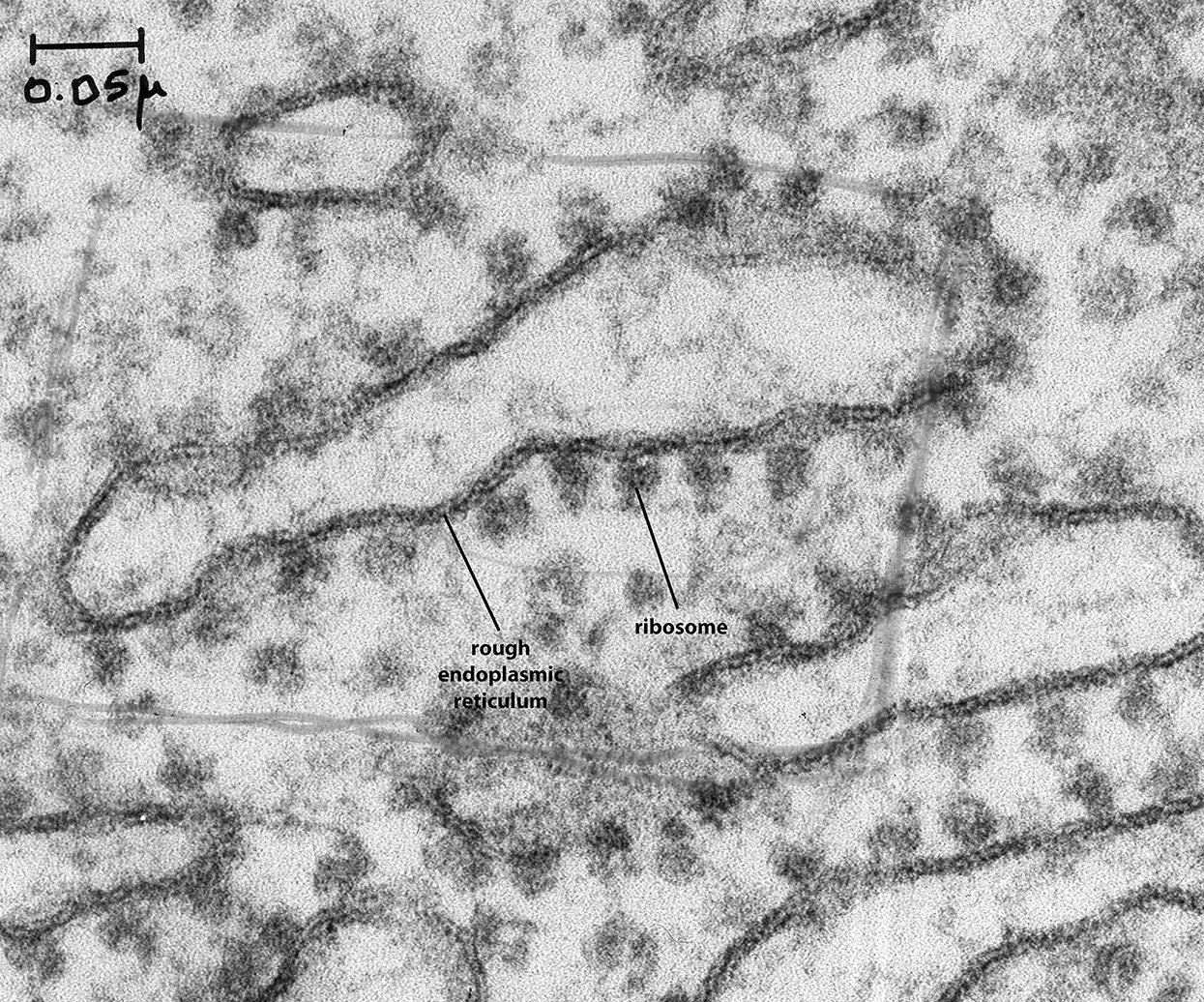 Ribosomes Electron Micrograph Ribosomes Electron Micrograph
